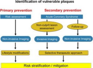 VULNERABLE PLAQUE – Dr Rajiv Desai